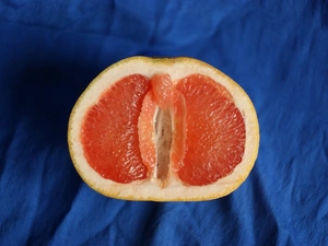 Blue Waffle STD: Is It Real? | STDWatch.com